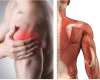 어깨통증 견갑하신경subscapular Nerve과 견갑하근 천안 아산 달천한의원 네이버 블로그